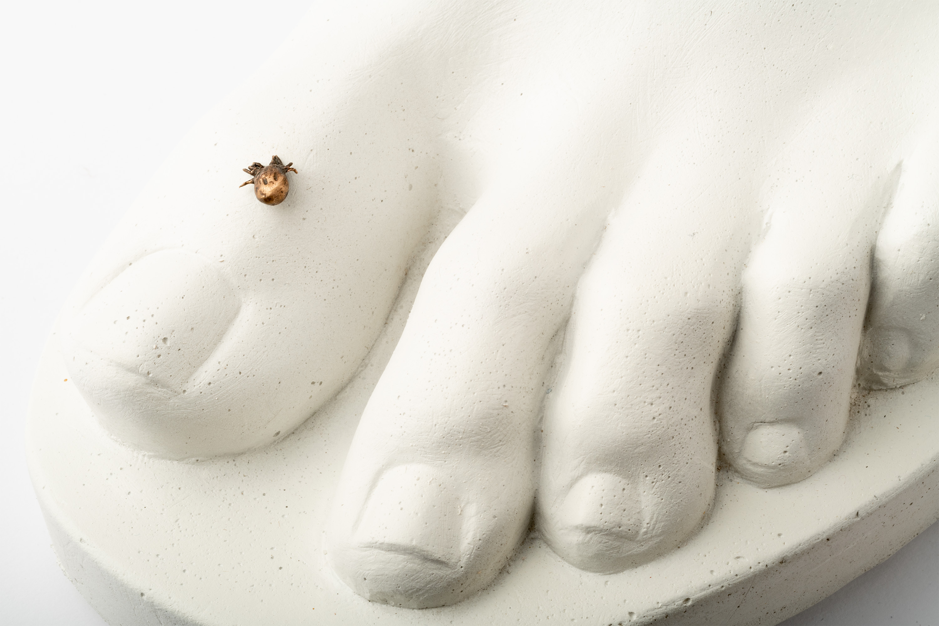 Sicker Leg – Kogo Gallery